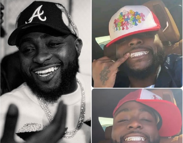 Davido spends over 500 million naira on new diamond teeth