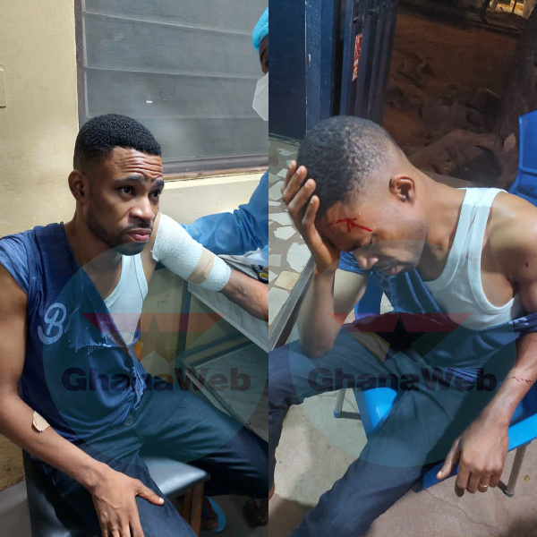 Kofi Adoma breaks silence on his eye shooting experience